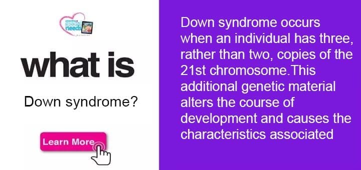 What is Down syndrome – Parenting Special Needs Magazine